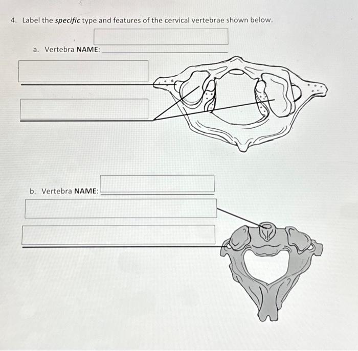 Solved 4. Label the specific type and features of the | Chegg.com