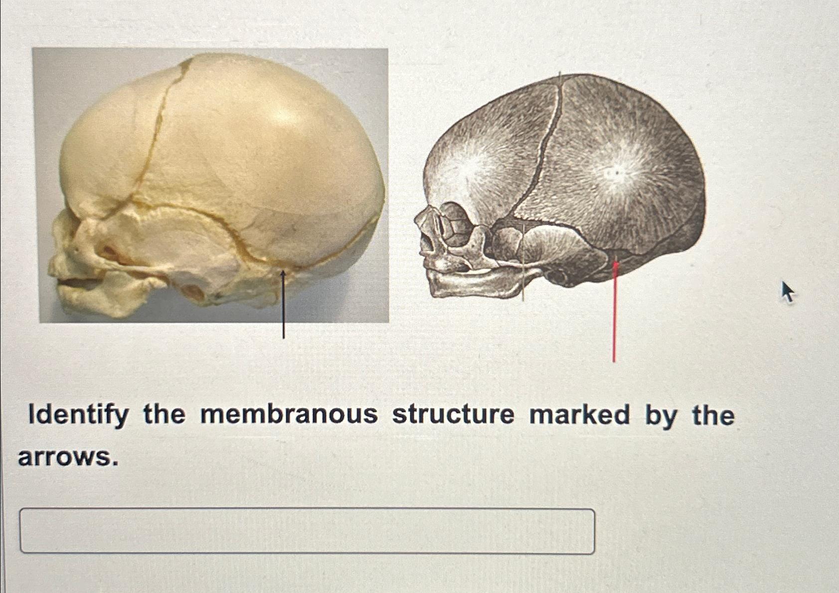 Solved Identify the membranous structure marked by the | Chegg.com