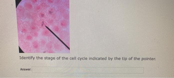 Solved Identify the stage of the cell cycle indicated by the | Chegg.com