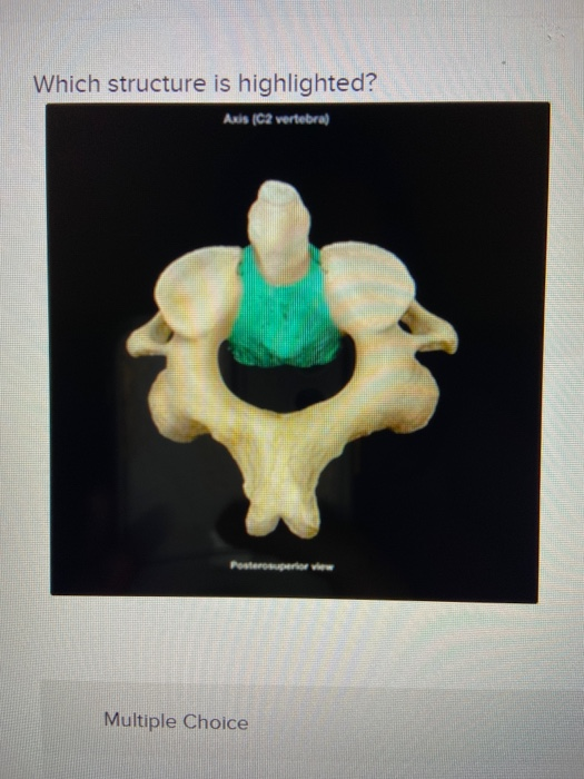Solved Which structure is highlighted? Axis (C2 vertebrad | Chegg.com