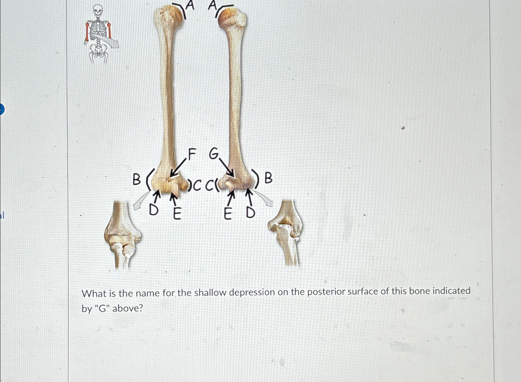 Solved What is the name for the shallow depression on the | Chegg.com