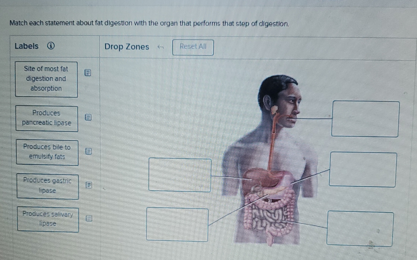 Solved Match each statement about fat digestion with the | Chegg.com