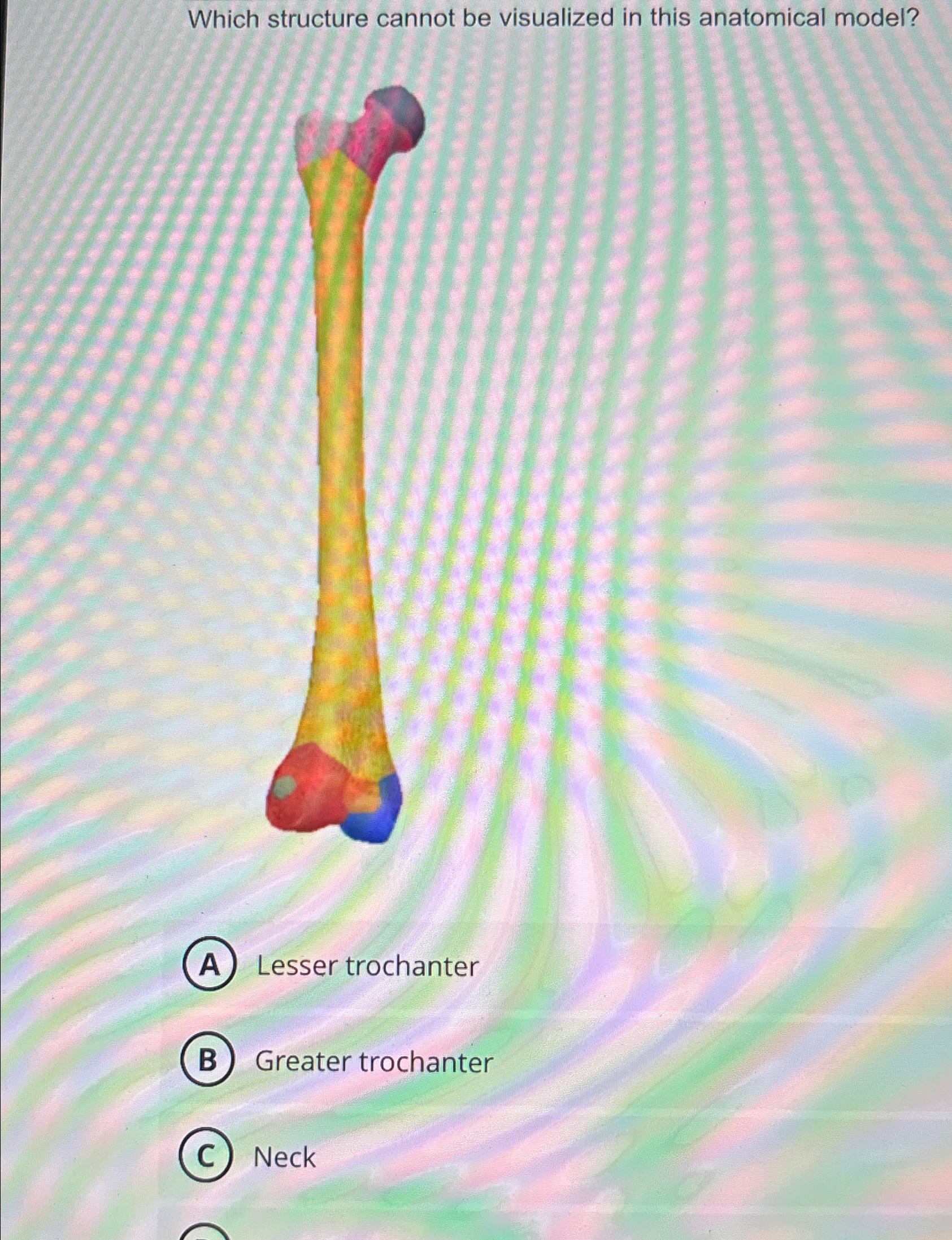 Solved Which structure cannot be visualized in this | Chegg.com