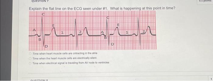 Solved Explain the flat line on the ECG seen under \#1. What | Chegg.com