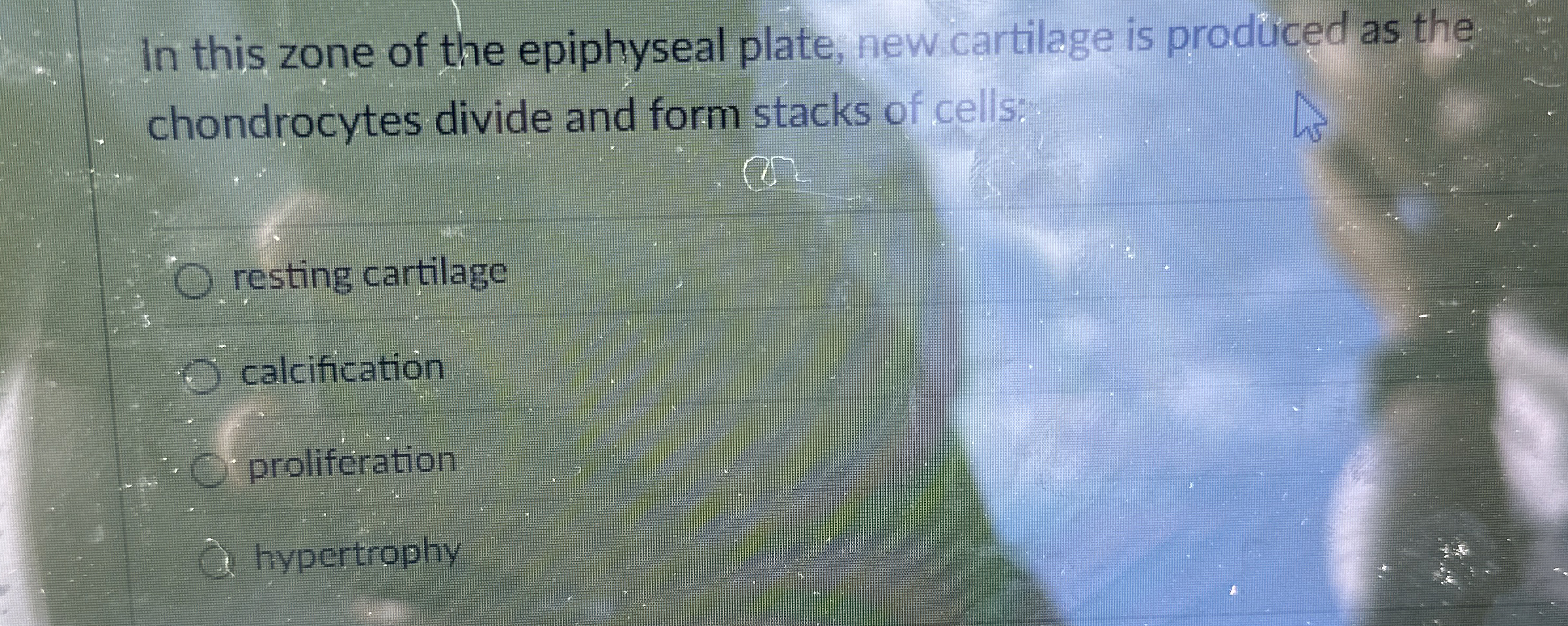 Solved In this zone of the epiphyseal plate, new cartilage | Chegg.com