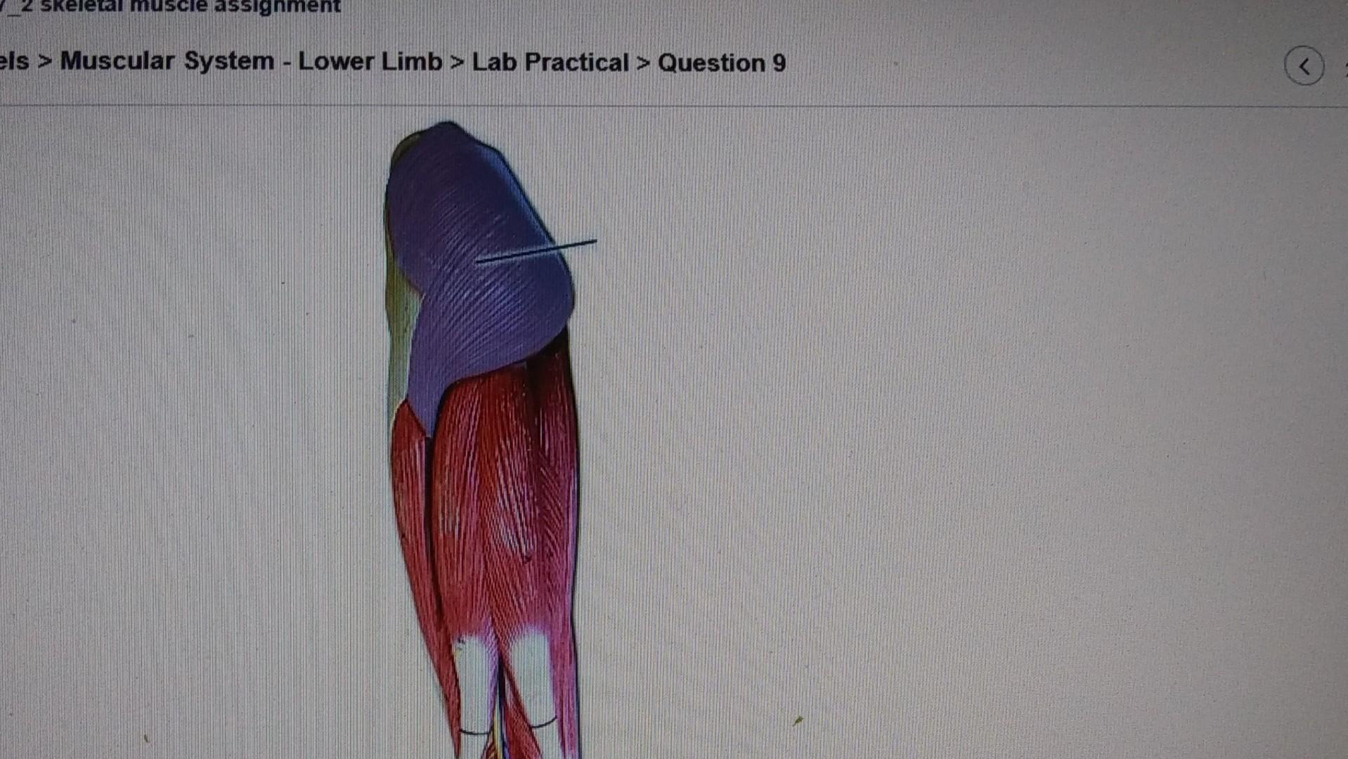 Solved Is > Muscular System - Lower Limb > Lab Practical > | Chegg.com
