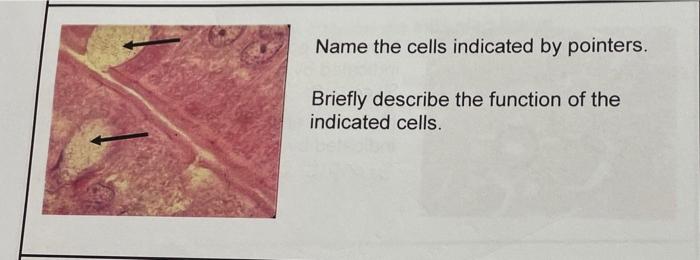 Solved Name the cells indicated by pointers. Briefly | Chegg.com