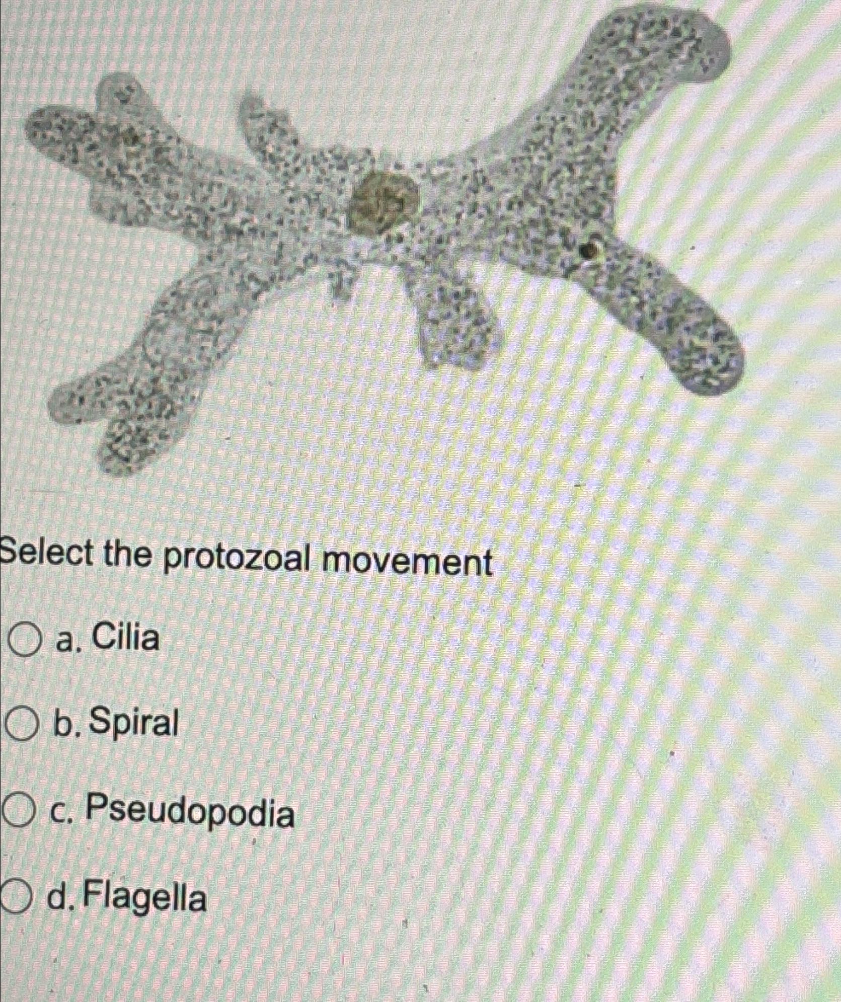 Solved Select the protozoal movementa. ﻿Ciliab. ﻿Spiralc. | Chegg.com