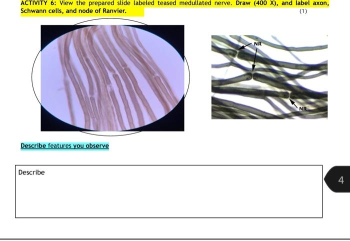 Solved ACTIVITY 6: View the prepared slide labeled teased | Chegg.com
