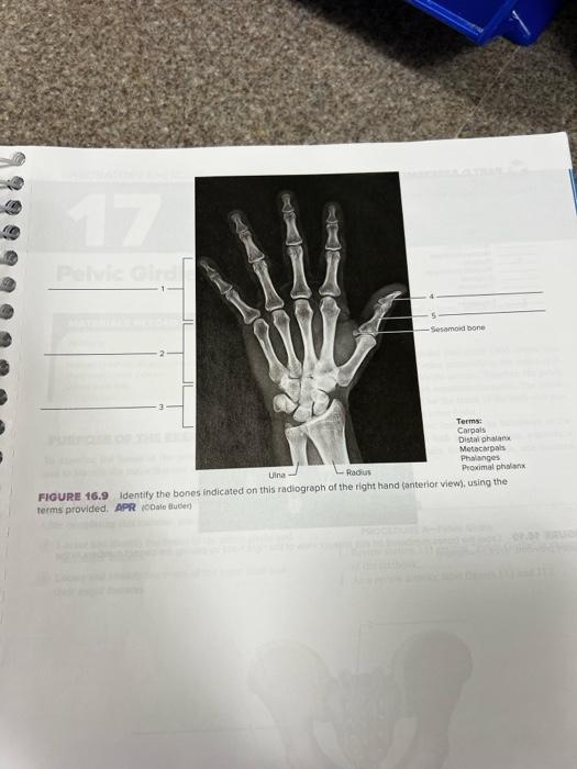 Solved FIOURE 46.9 Identify the bones indicated on this | Chegg.com
