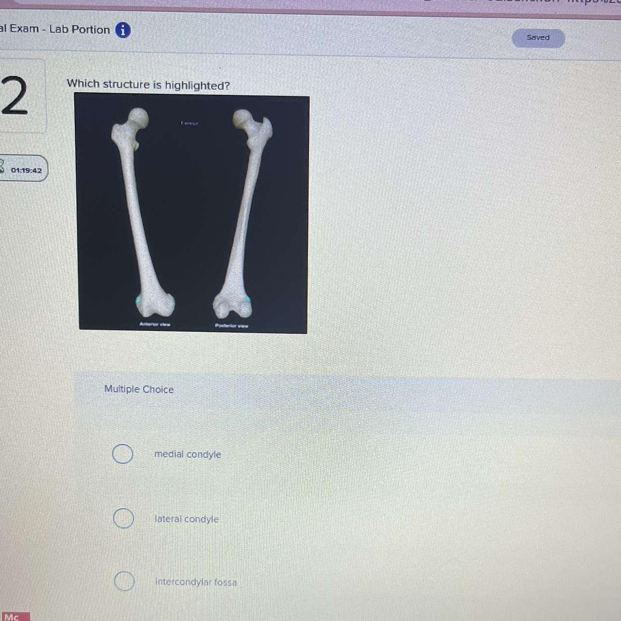 Solved Exam - ﻿Lab Portion iWhich structure is | Chegg.com