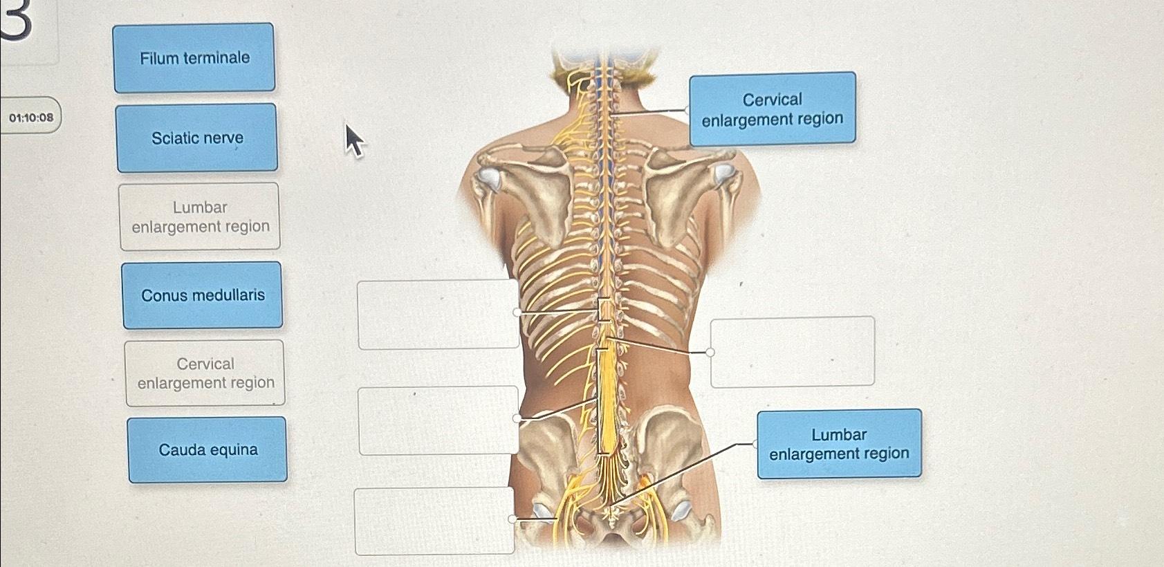 Solved Filum terminaleSciatic nerveLumbar enlargement | Chegg.com