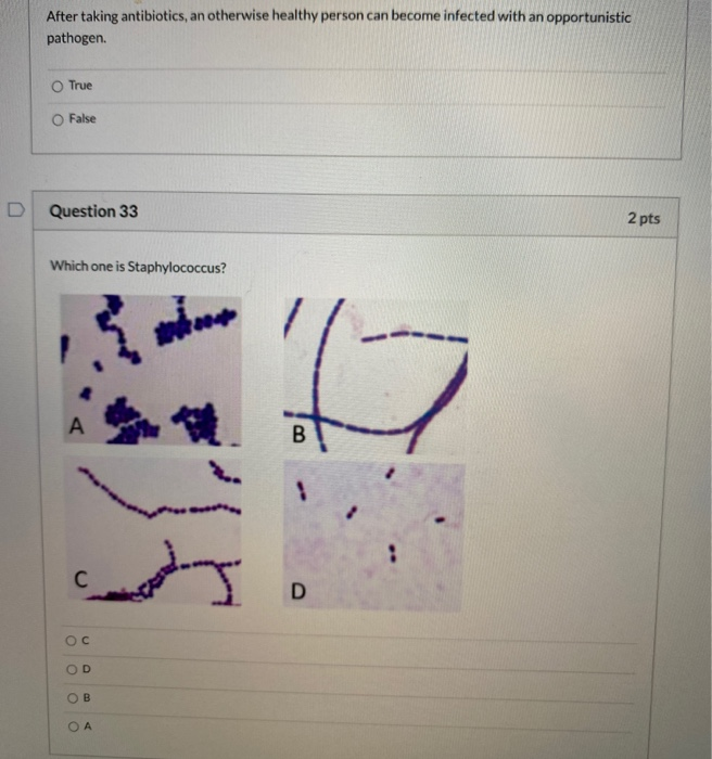 Solved CNA plates test for hemolysis patterns; this one is O | Chegg.com