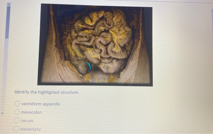 Solved 3 3 Identify the highlighted structure, OR