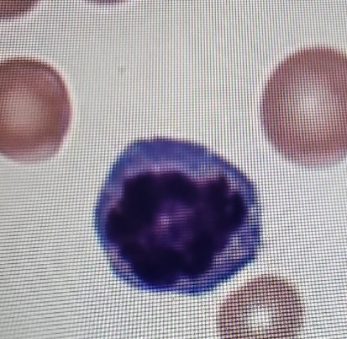 hemotology peripheral blood smear cells identify | Chegg.com