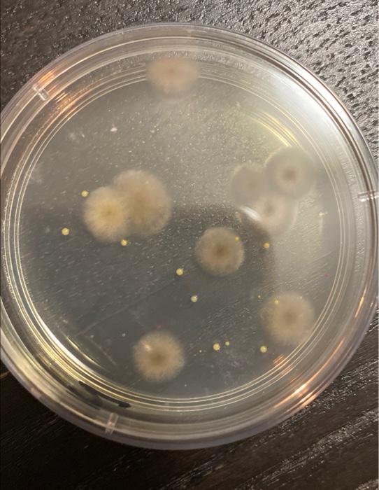 Solved Table 2: Initial Reserved Plate Colony Growth | Chegg.com