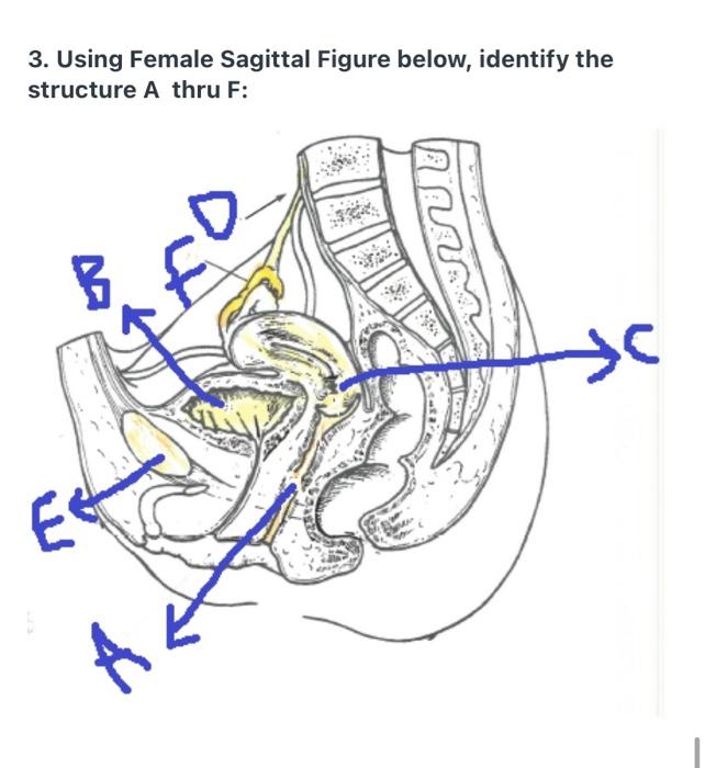Solved using femalr sagittal fugure below , identify the | Chegg.com