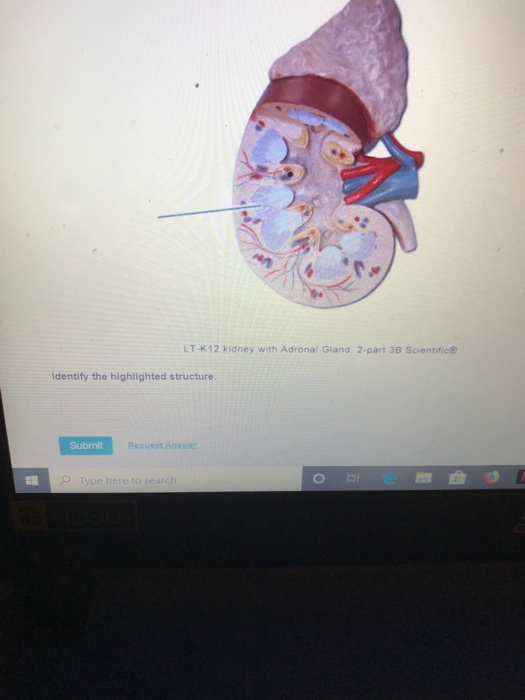 Solved LT-K12 kidney with Adronal Gland, 2-part 3B | Chegg.com