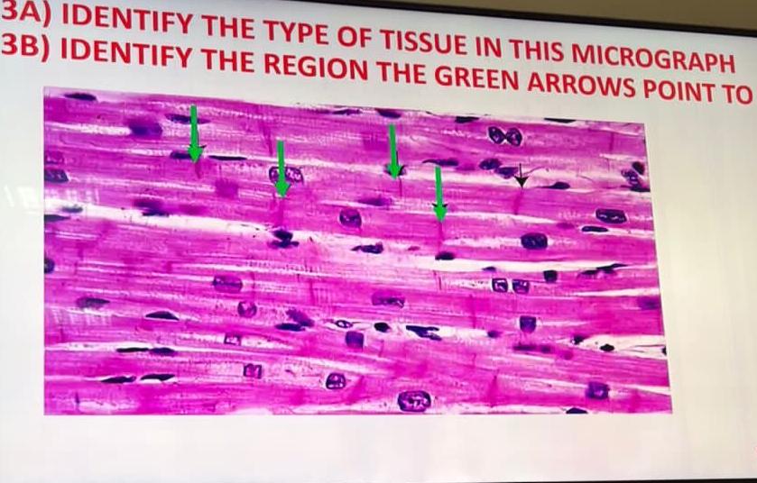 Solved 3A) ﻿IDENTIFY THE TYPE OF TISSUE IN THIS MICROGRAPH | Chegg.com