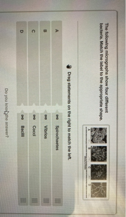 Solved The following micrographs show four different | Chegg.com Solved The following micrographs show four different | Chegg.com