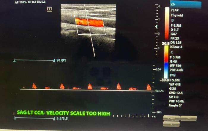 Solved explain how changing the velocity scale will effect | Chegg.com