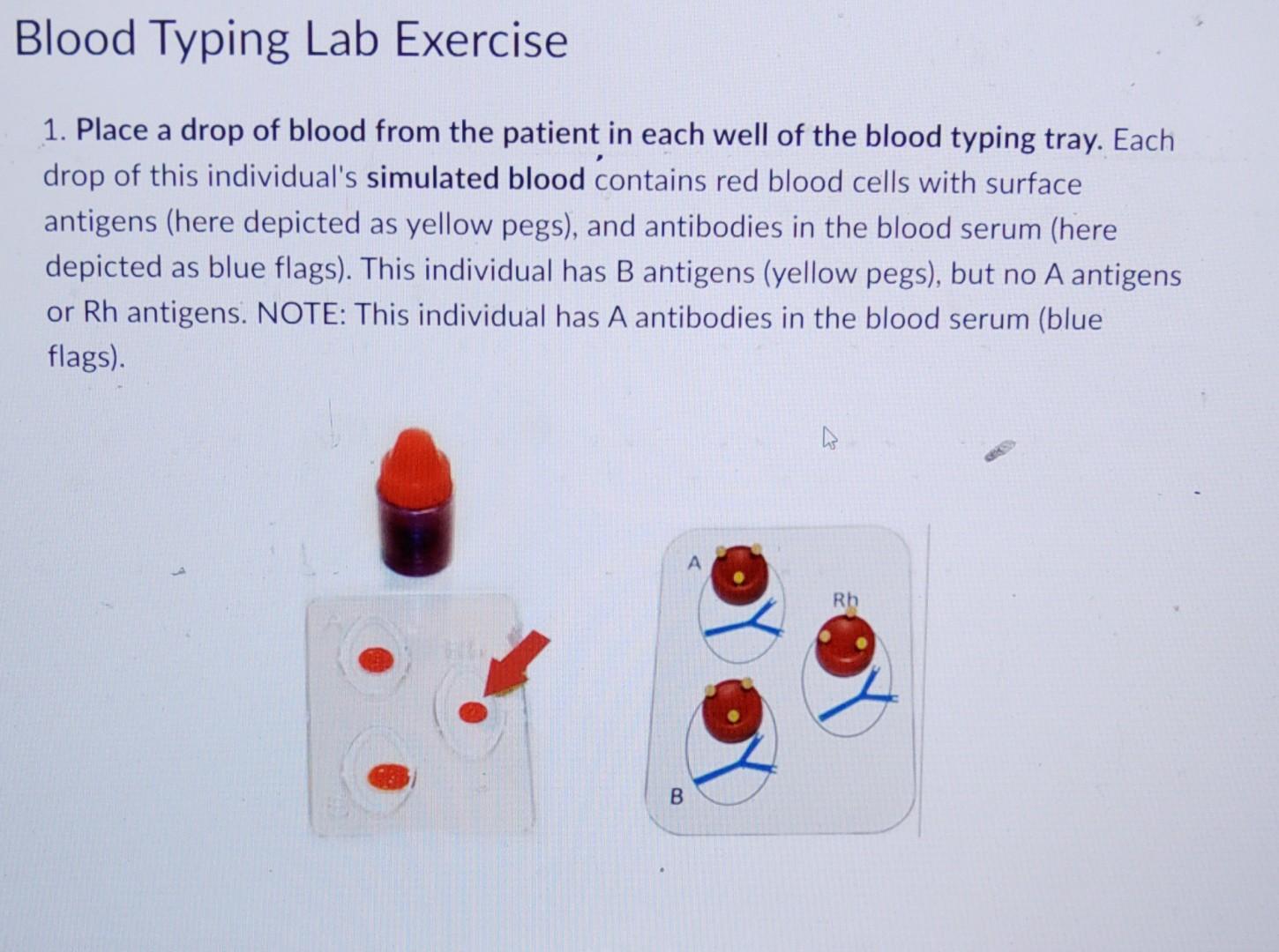 Solved Review of blood typing terminology: Red blood cells | Chegg.com