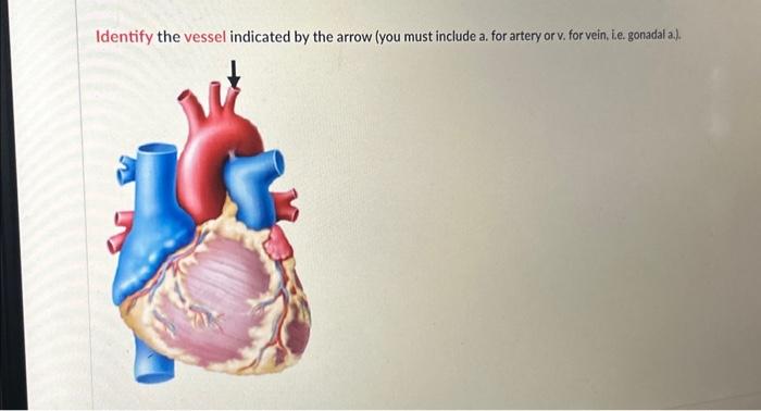 Solved Identify the vessel indicated by the arrow (you must | Chegg.com