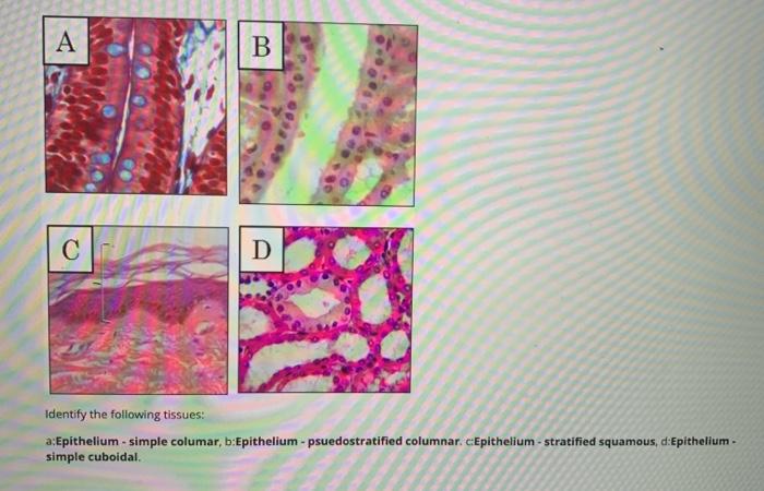 Solved A B C D Identify the following tissues: | Chegg.com