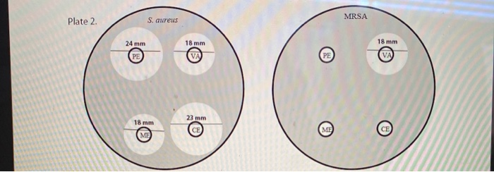 Solved Analyze the zones of inhibition for each antibiotic | Chegg.com