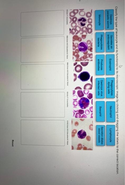 Solved Classify the type of leukocyte and its function(s) to | Chegg.com