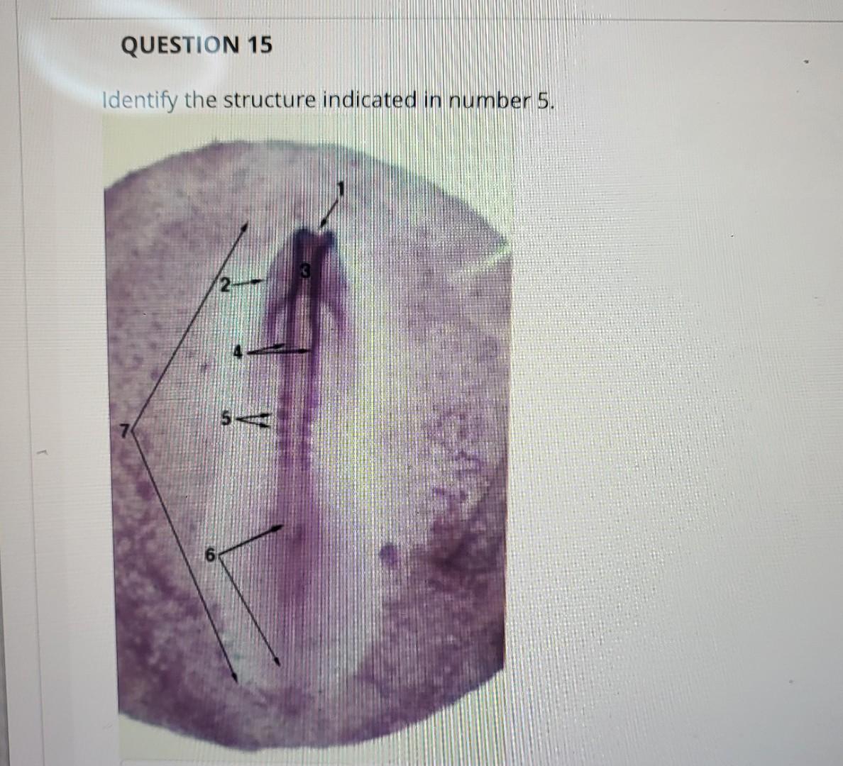 Solved Identify the structure indicated in number | Chegg.com