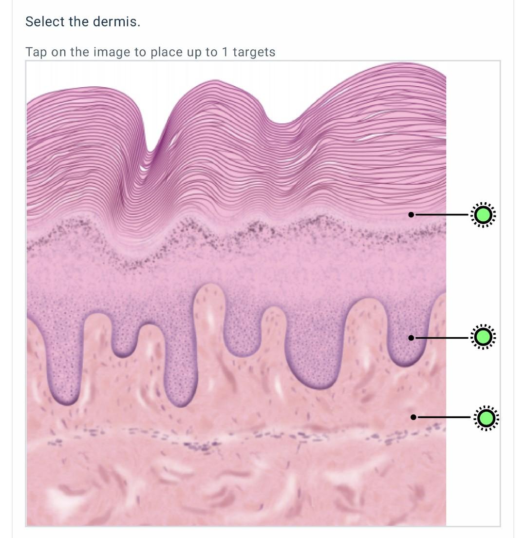 Solved Select the dermis. | Chegg.com