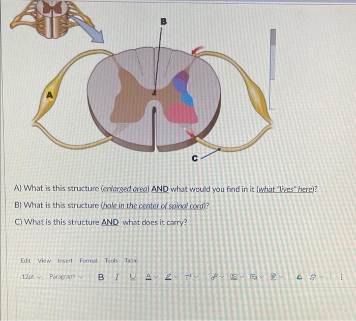 Solved с A) What is this structure (enlarged area) AND what | Chegg.com