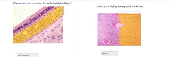 Solved Which embryonic germ layer forms the highlighted | Chegg.com