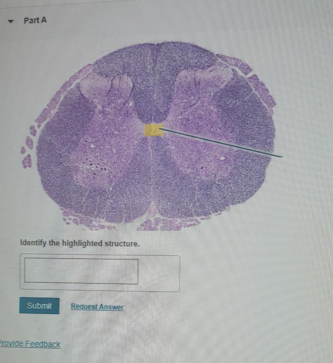 Solved Identify the highlighted structures. Identify the | Chegg.com