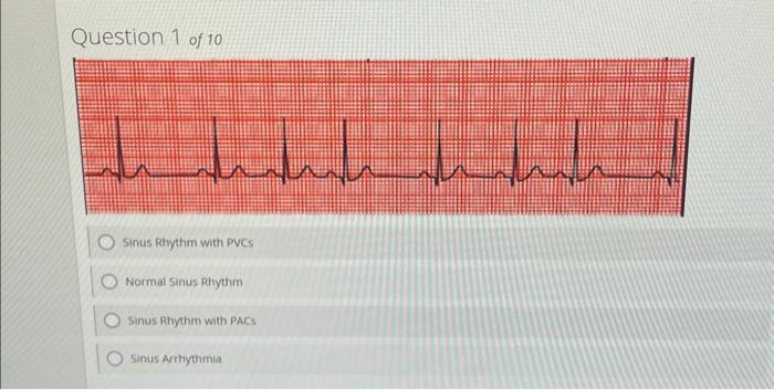 Question 1 of 10 Sinus Rhythm with PVCs Normal Sinus | Chegg.com
