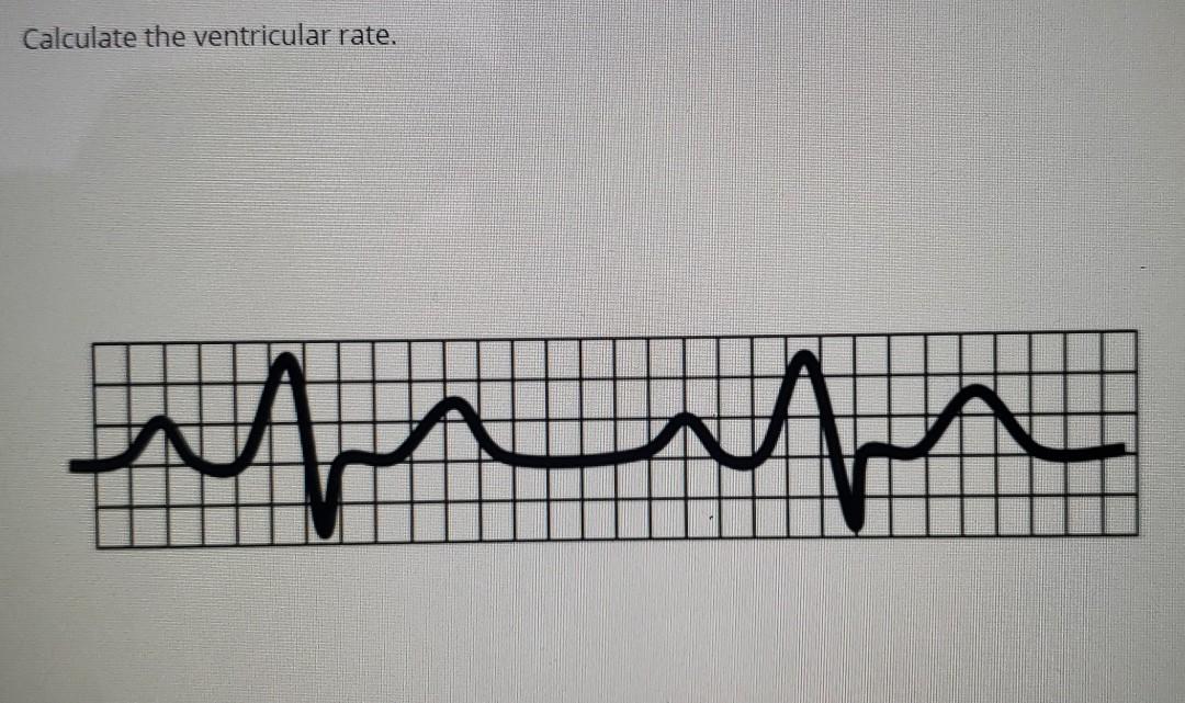 Solved Calculate the ventricular rate. | Chegg.com