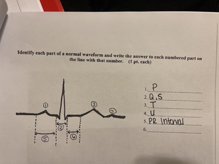 Solved Identify each part of a normal waveform and write the | Chegg.com