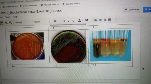 Biochemical Tests Lab Exercise 1. Fill in the | Chegg.com