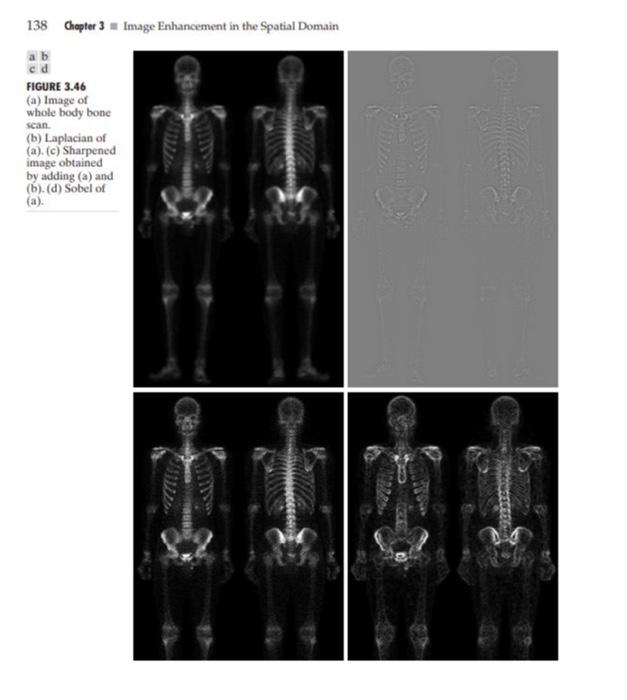 Solved 138 Chepter 3 = Image Enhancement in the Spatial | Chegg.com