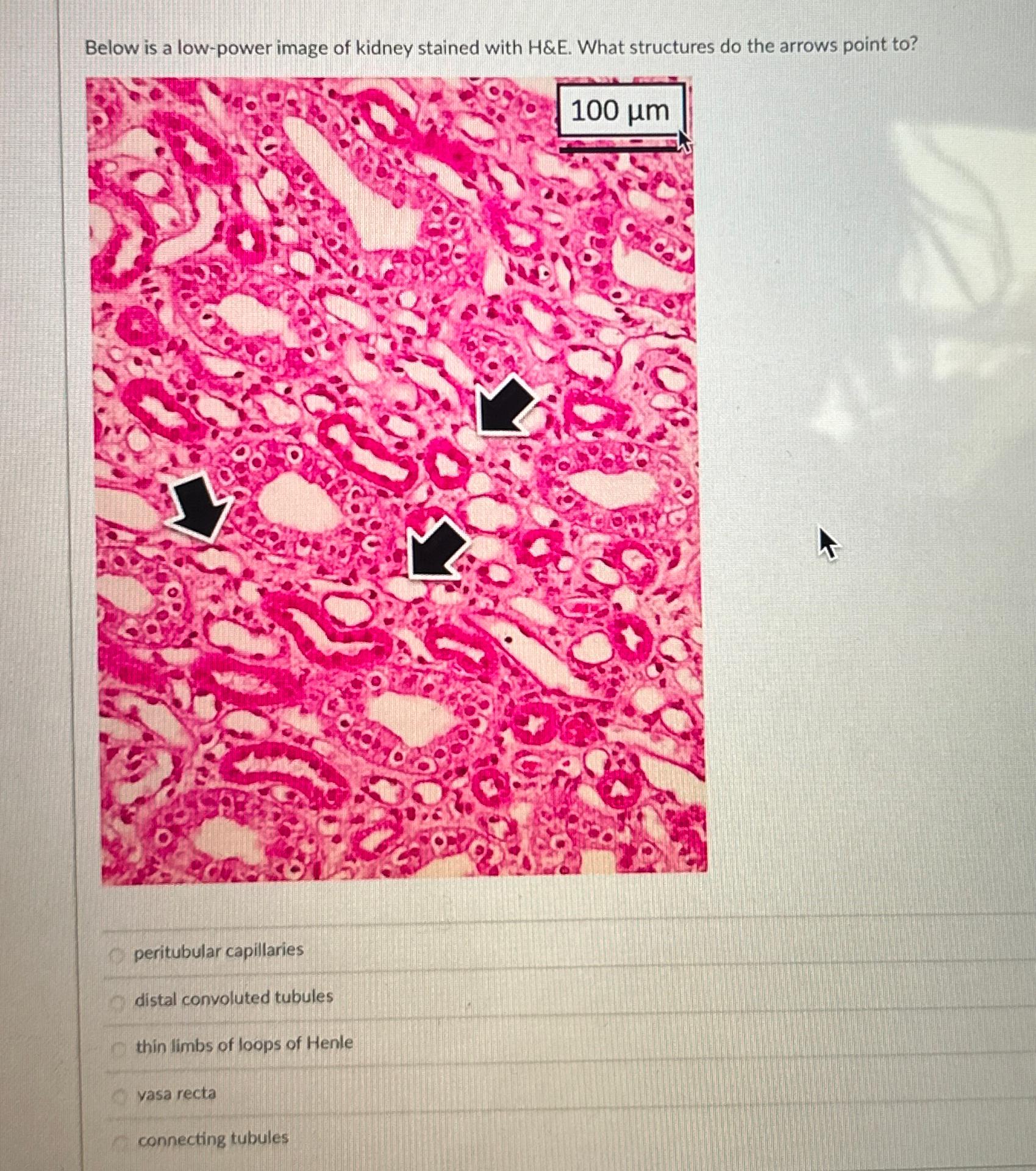 Solved Below is a low-power image of kidney stained with | Chegg.com