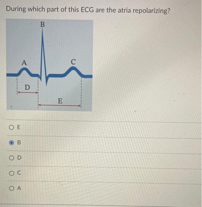 Solved During which part of this ECG are the atria | Chegg.com