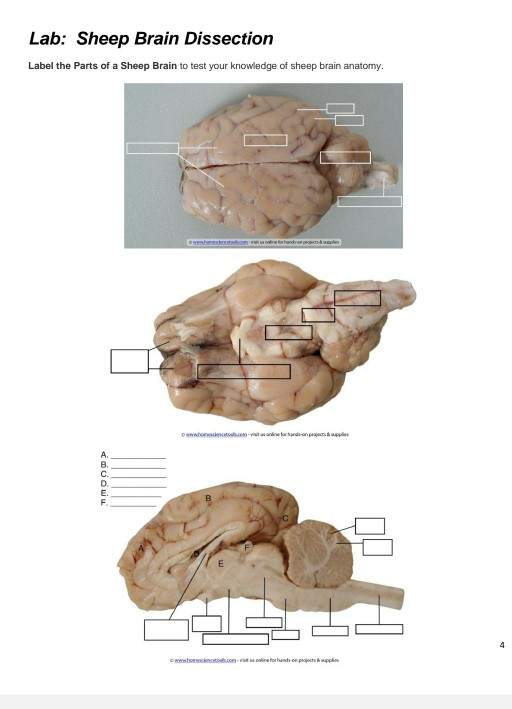 Solved Lab Sheep Brain Dissection Before Starting This Chegg