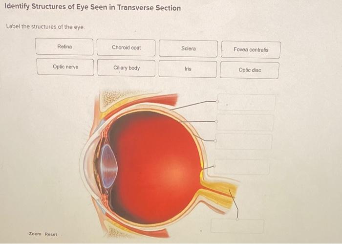 Solved Identify Structures of Eye Seen in Transverse Section | Chegg.com