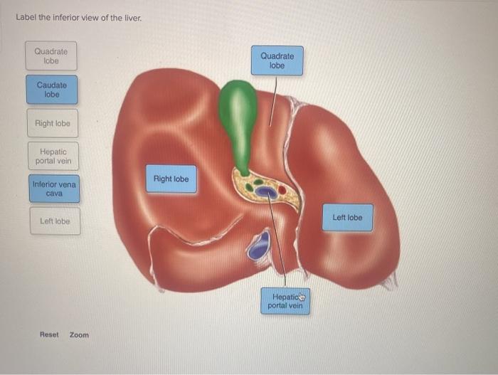 Solved Label the inferior view of the liver. Quadrate lobe | Chegg.com