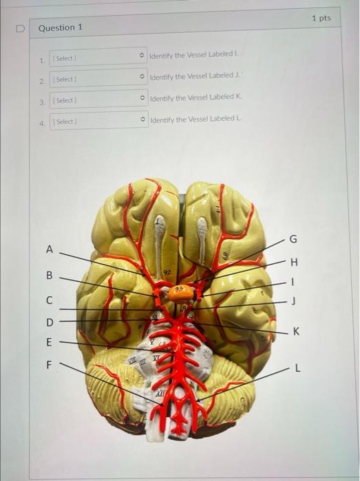 1. Identity the Vessel Labeled L 2. Identify the | Chegg.com
