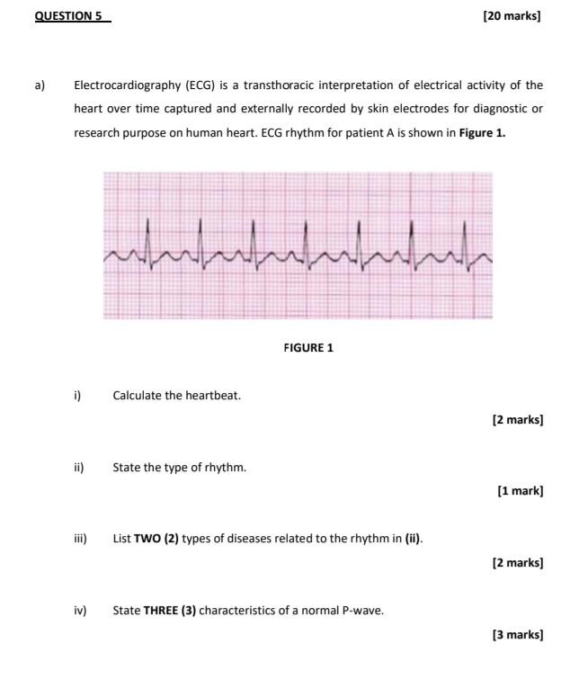 Solved QUESTION 5 [20 marks) a) Electrocardiography (ECG) is | Chegg.com