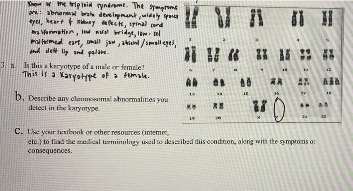 Solved Kromo of the triploid syndrome. The symptoms we: | Chegg.com