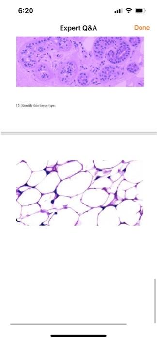 Solved 15. Identify thin nasue type | Chegg.com