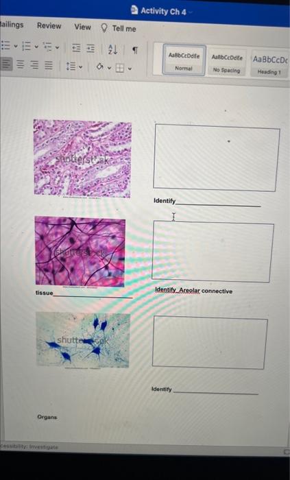 Solved ldentify Areolar connective Identify Lab Activity | Chegg.com
